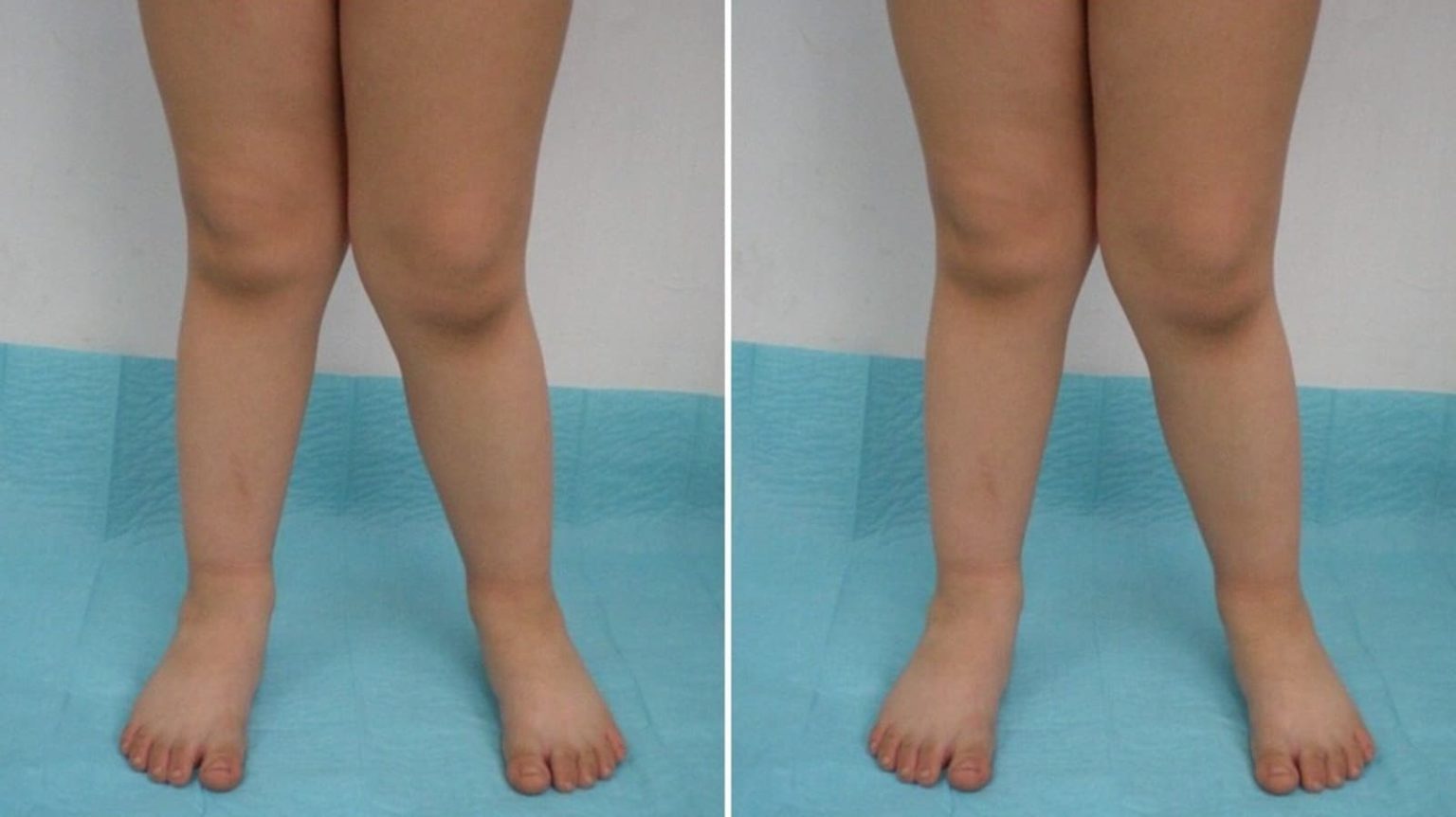 CAN YOU JOIN THE MERCHANT NAVY WITH THESE MEDICAL CONDITIONS? - Merchant Navy Decoded